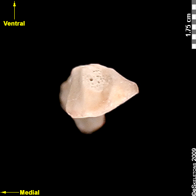 Bone Viewer | eSkeletons