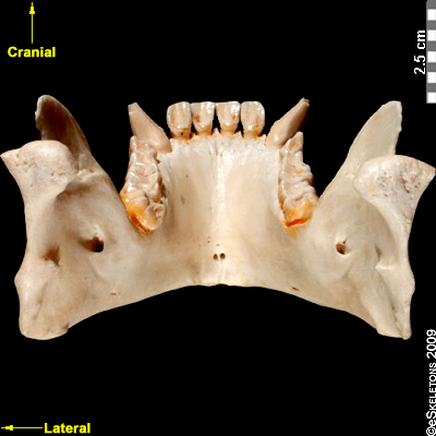Bone Viewer | eSkeletons
