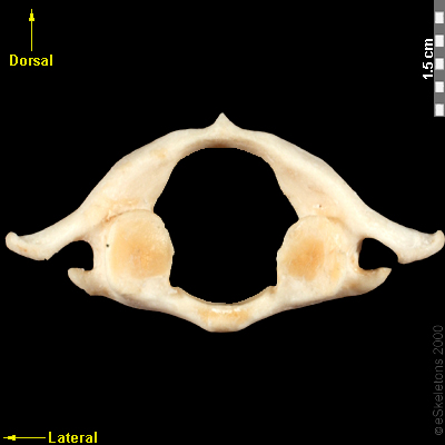 Bone Viewer | eSkeletons