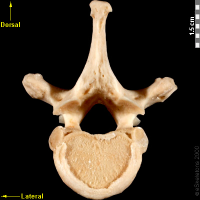 Bone Viewer | eSkeletons