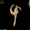 Bone Viewer | eSkeletons