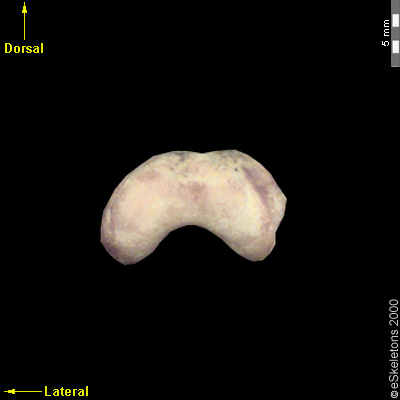 Bone Viewer | eSkeletons