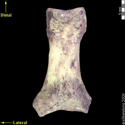Bone Viewer | eSkeletons
