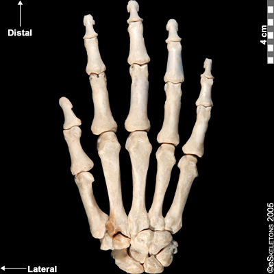 Bone Viewer | eSkeletons
